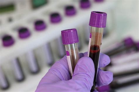 Nhs To Trial Blood Test That Can Detect Over 50 Cancer Types 3 Quarks