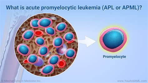 Slide Show Understanding Aml