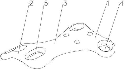 Talonavicular Fusion Plate Eureka Patsnap