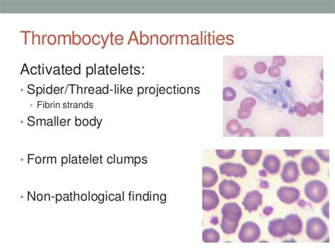 Hematology Basics Pt 2