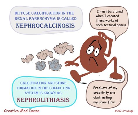 Nephrocalcinosis Vs Nephrolithiasis Creative Med Doses