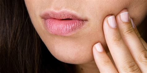 Pimples On Tongue Under On Tip Side Or Back And Getting Rid Of