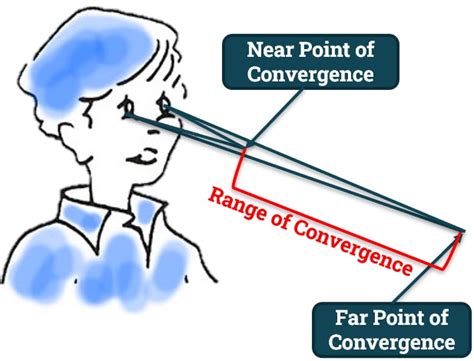 Convergence Of Eyes Everything You Need To Know About Smart Optometry