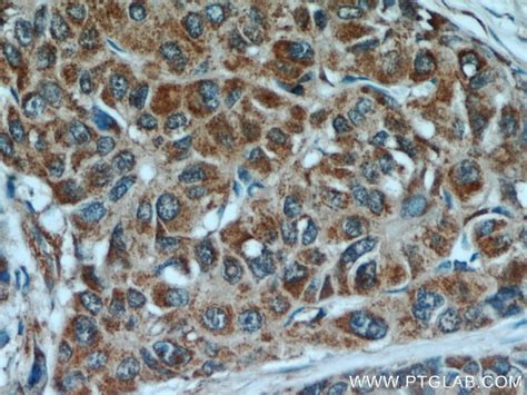 Peg10 Antibody 14412 1 Ap Proteintech