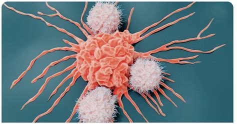 Peter Flynn On Linkedin Industry Appetite For Natural Killer Cells