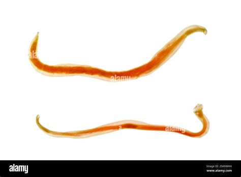 Light Micrograph Of Male At Top And Female Hookworms Ancylostoma