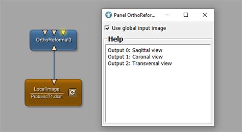 Example 1 2 Dicom Coordinate Systems