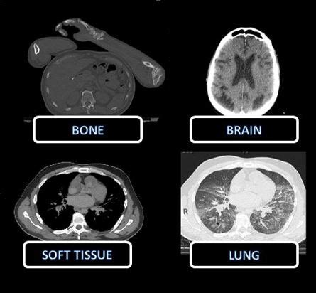 MOCK REGISTRY 2 Flashcards Quizlet
