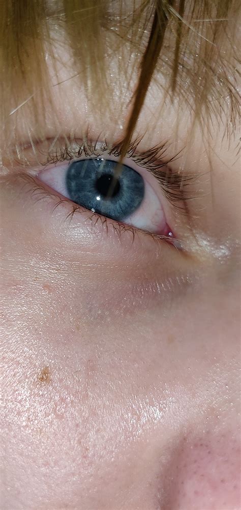 Rate My Eye Reyes