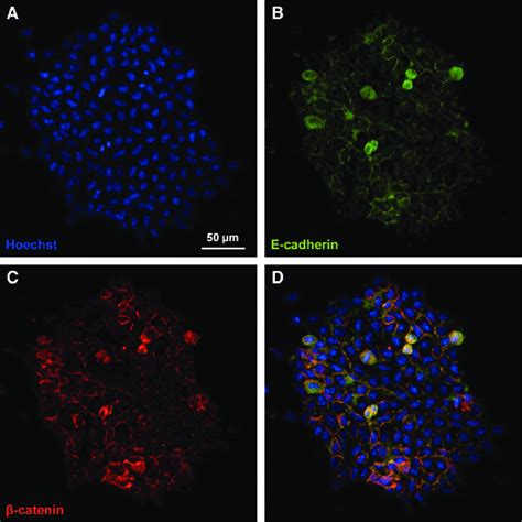 B Catenin And Ecadherin Expression Patterns Within Embryonic Stem Cells