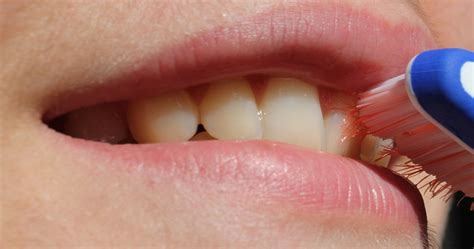Negative Effects Of Not Brushing Your Teeth At Night