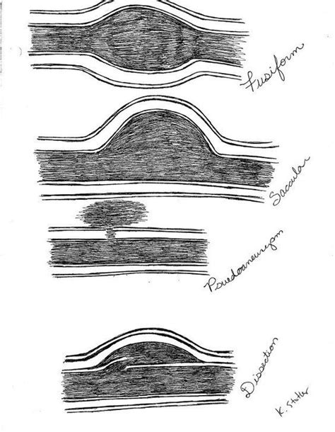 Medical Ultrasound Ultrasound Sonography Ultrasound