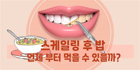 스케일링 후 식사 언제부터 가능할까 주의 사항 알아보기 Step To Health건강정보