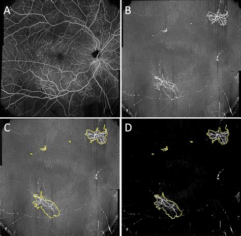 Manual Segmentation And Image Processing For Quantitative Analysis Of