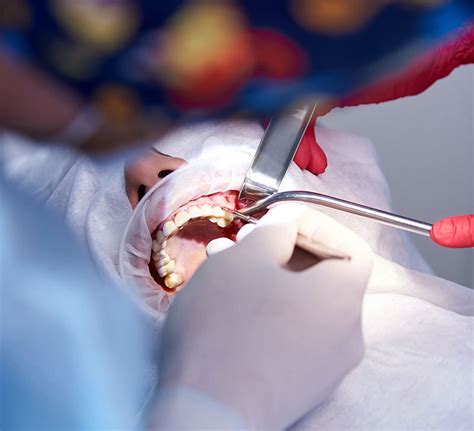 Top Rated Sinus Lift Specialists In Yorba Linda CA