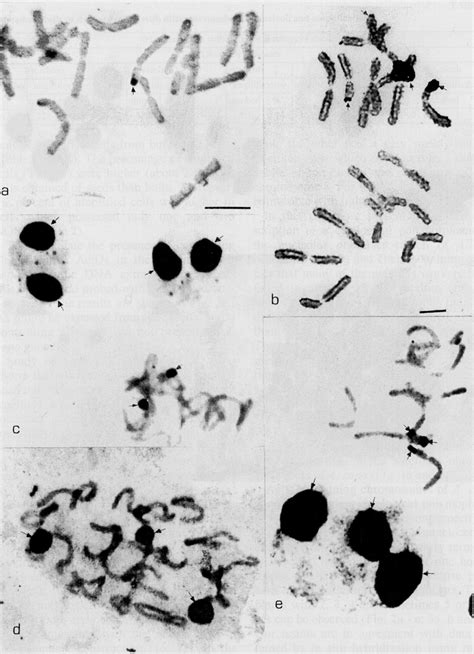 A E A B Metaphase Chromosomes Of A Cepa After Silver Staining With