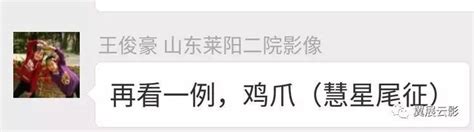 球形肺不张与球形肺炎的鉴别