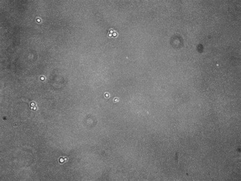 Saccharomyces Cerevisiae Microscope 100x