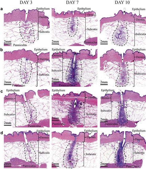 Representative Examples Of Histopathology Over The Course Of 3 7 And