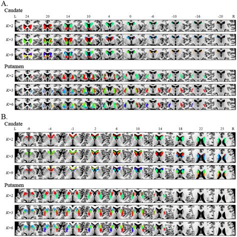 Functional Connectivity Based Parcellation Of The Caudate A And Download Scientific Diagram