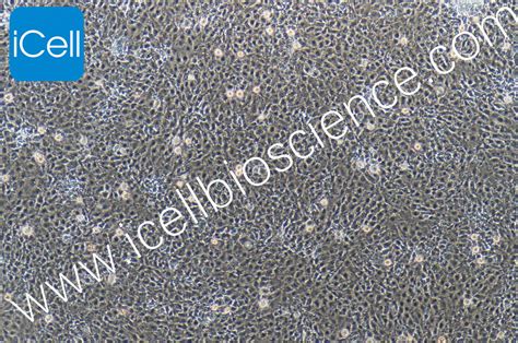 内皮祖细胞 赛百慷 上海 生物技术股份有限公司