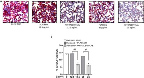 Nutraceutical Polyphenols Extract Decreases Intracellular Neutral Lipid