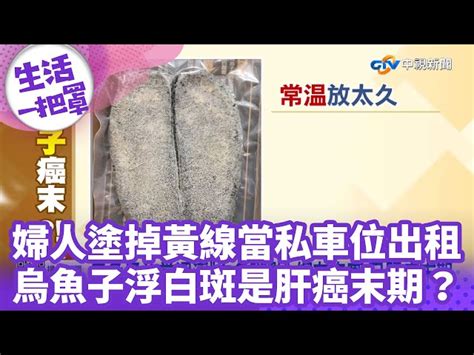 【生活一把罩】婦人塗掉黃線當私車位出租 烏魚子浮白斑是肝癌末期？