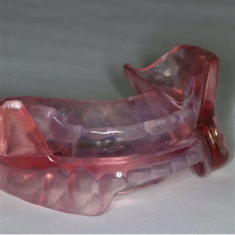 Measurement Taking In Mandibular Advancement Appliance Fabrication