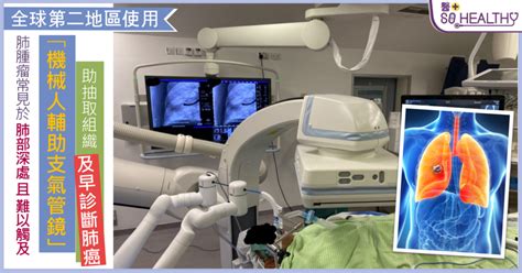 防靜電攻略 10招放電小竅門 醫so Healthy