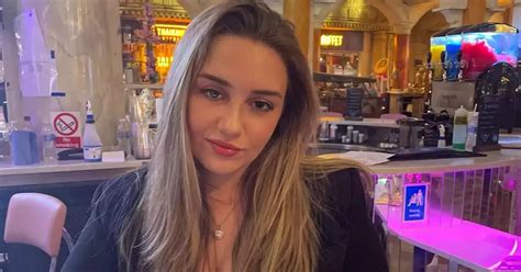 Scots Woman Called Mike Wazowski By Bullies After Losing Eye Signs As Model United Kingdom