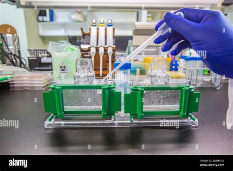 Western Blot Analysis Use As Protein Analysis For Protein Detection This Technique Use In
