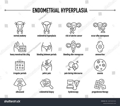 Endometrial Hyperplasia Symptoms Diagnostic Treatment Vector Stock