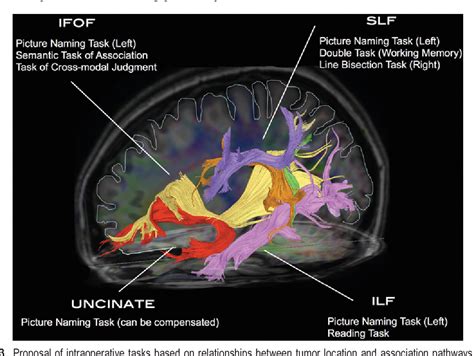 Figure 1 From Selection Of Intraoperative Tasks For Awake Mapping Based