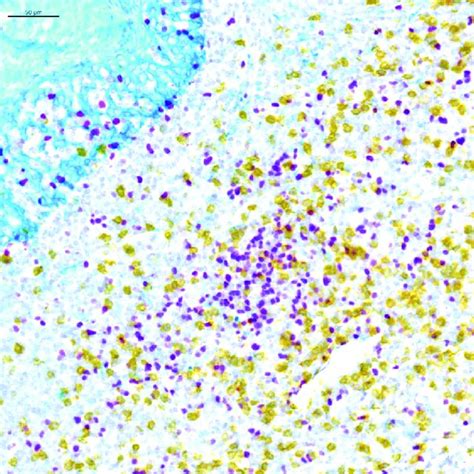 Multiplex Immunofluorescence If Using Tyramide Signal Amplification