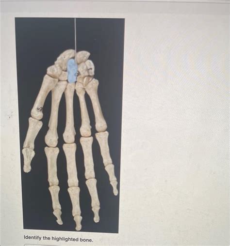 solved identify the highlighted bone