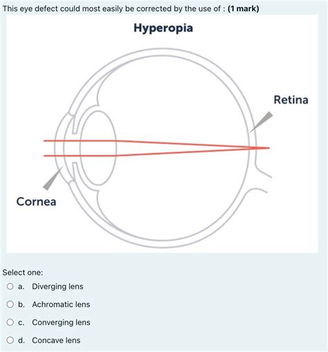 Solved This Eye Defect Could Most Easily Be Corrected B