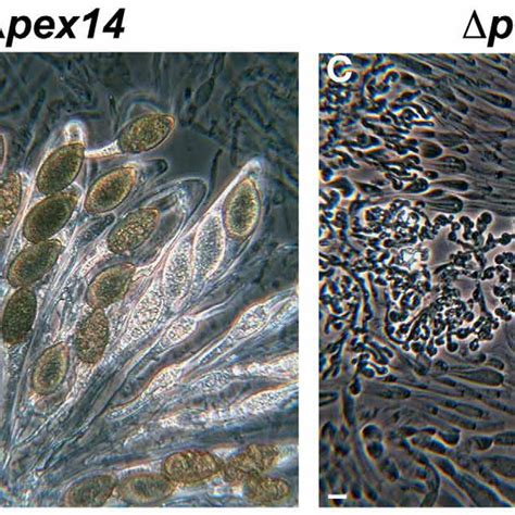 Examples Of Sexual Development Defects Produced By Deficient