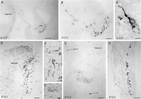 Gal Immunoreactivity In Parasagittal Sections Of Embryonic Gnz 3252