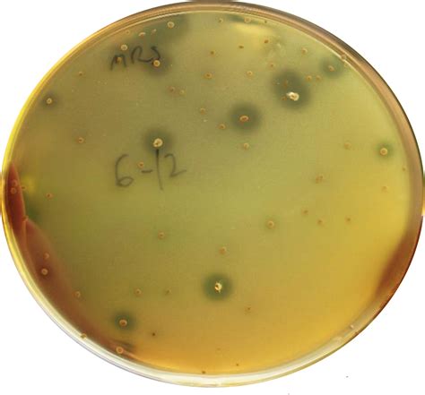 A Method To Assess Bacteriocin Effects On The Gut Microbiota Of Mice