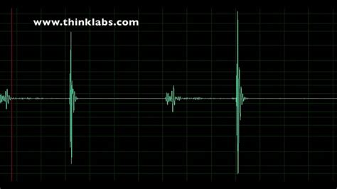 Prosthetic Aortic Valve Youtube