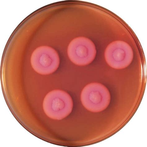 Bacillus Cereus Agar Acc To Mossel Caja 20uds Caybacb