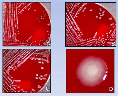 Yersinia Pestis Properties Disease Lab Diagnosis • Microbe Online
