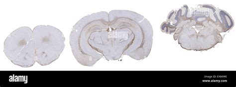 Gfap Immunoperoxidase Staining Of Formalin Fixed Paraffin Embedded
