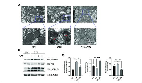 Osa Model Mice Exhibit Excess Autophagic Activity And Autophagic Flux