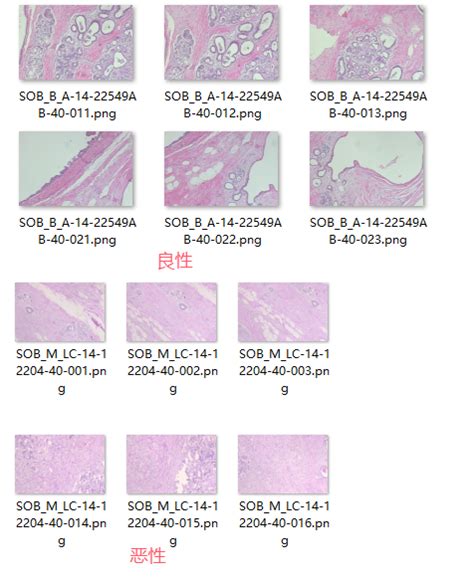 多示例学习模型的力量：深度解析病理图像分类的ai实现 病理图像深度学习模型 csdn博客