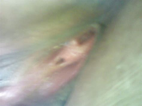 Clampandme Porn Pictures Xxx Photos Sex Images 189273 Pictoa