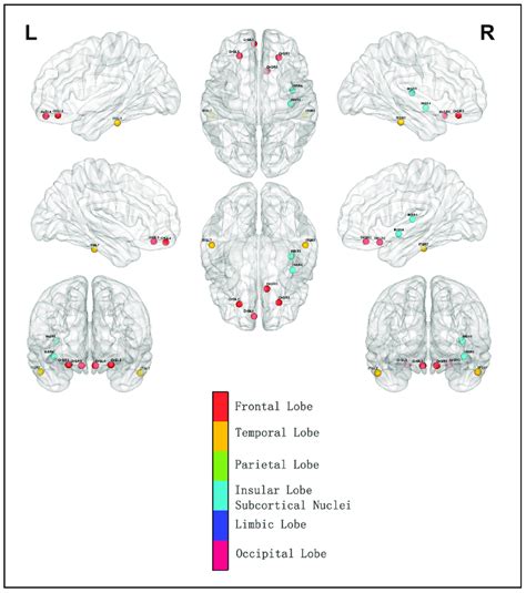 Rois Selected Based On Sfc Strength Feature Intersection Projected Onto Download Scientific