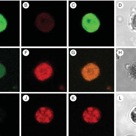 Pdf Chloroplast To Chromoplast Transition In Tomato Fruit Spectral