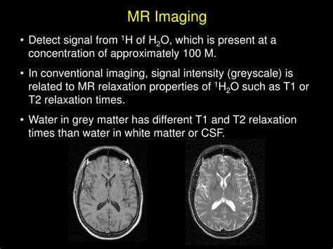 Ppt Mapping Cortical Development Using Diffusion Tensor Imaging Powerpoint Presentation Id