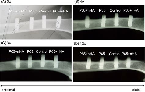 Novel Nano‐hydroxyapatite Coating Of Additively Manufactured Three